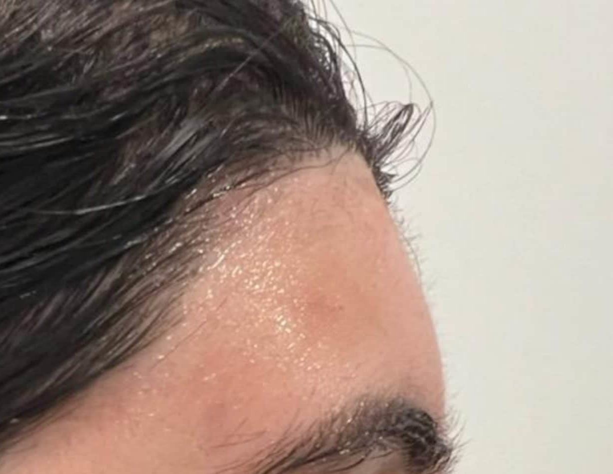 Versa - VIP Plastic Surgery