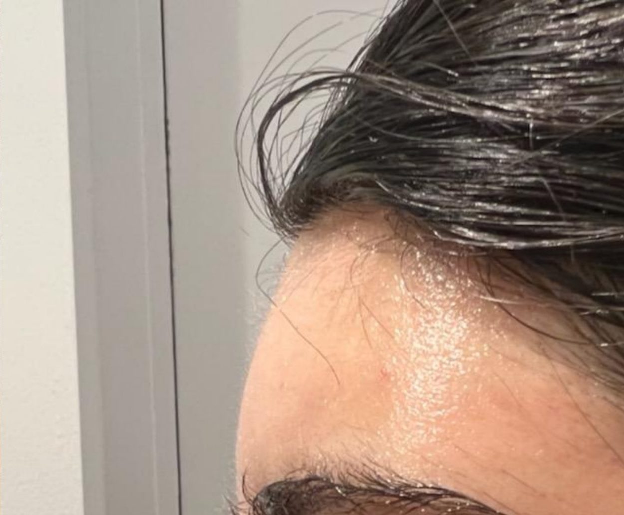 Versa - VIP Plastic Surgery